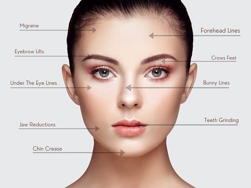 The Remarkable History and Evolving Uses of Botox in Medicine and ...